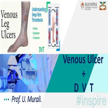 Venous Ulcer and Deep Vein Thrombosis - Causes & Management | PDF