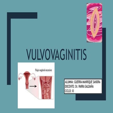 VULVOVAGINITIS.pptx