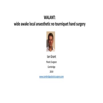 WALANT: wide awake local anaesthetic no tourniquet hand surgery | PPTX