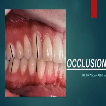 Dentistry pptx on topic of normal occlusion | PPT