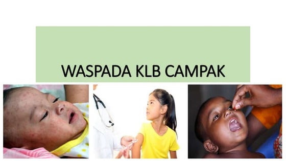 CAMPAK RUBELLA.pptx