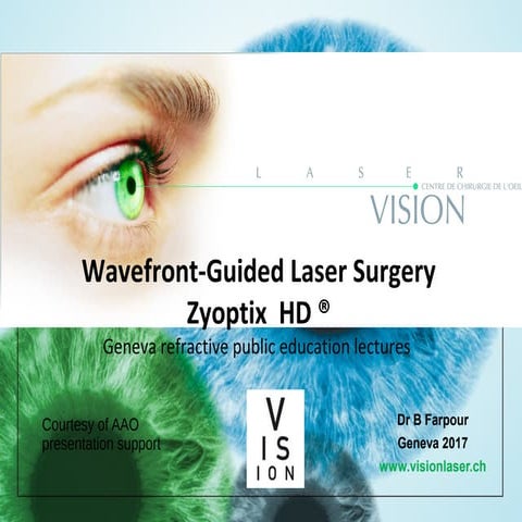 Wavefront guided laser surgery - Zyoptic HD ® 2017 | ODP