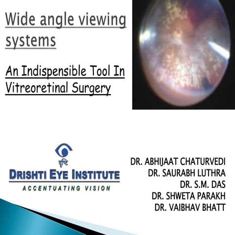 Wide angle viewing system | PPTX