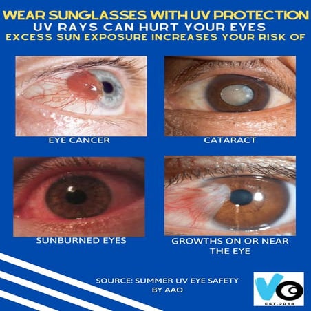 Effects of uv to the eyes | PDF