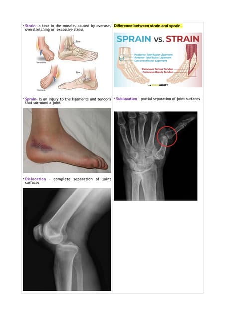Sports Injuries (Grade 11 PE and HEALTH) | PPT