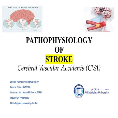 Week 9 Pathophysiology_Ms. Asma El-Shara Stroke (1).pdf