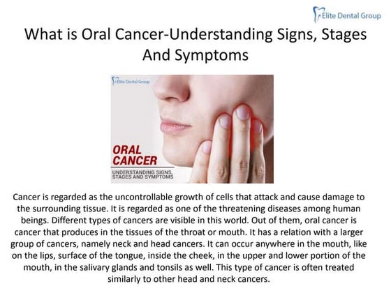 Oral Cancer – Symptoms, Causes, Stages, Risk Factors, Complications ...