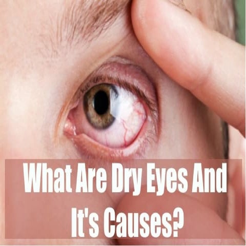 7 types of common eyes infections | PPT