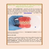 What Are The Benefits Of Having A Teeth Alignment Procedure