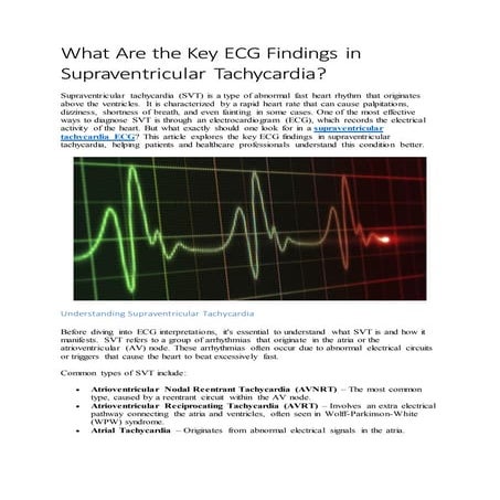What Are the Key ECG Findings in Supraventricular Tachycardia? | PDF