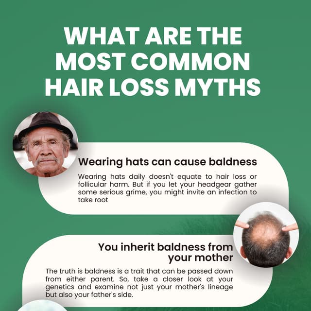 What Are The Most Common Hair Loss Myths.pdf