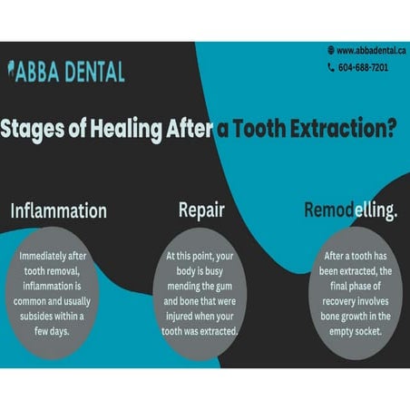 What Are the Stages of Healing After a Tooth Extraction.pdf