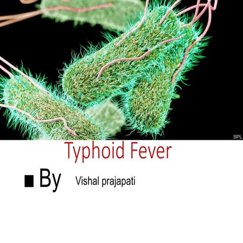 What are typhoid by vishal Prajapati | PPTX