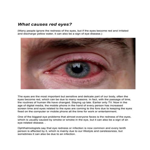 What causes red eyes.pdf