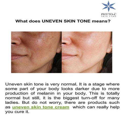 What does UNEVEN SKIN TONE means? | PPTX