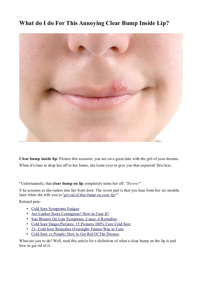 What Do I Do For This Annoying Clear Bump Inside Lip what-do-i-do-for-this-annoying-clear-bump-inside-lip