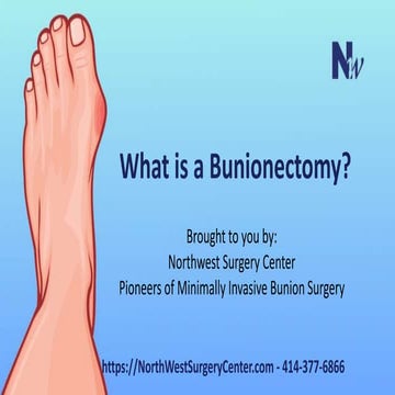 What Is A Bunionectomy? | PPTX