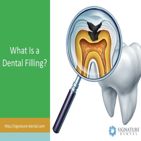 What is a Dental Filling by Signature Dental | PPT
