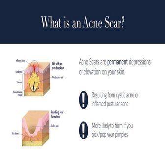 What is an acne scar? | PDF | Skin and Dermatology | Diseases and ...