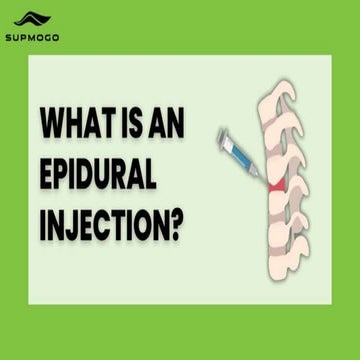 What is an Epidural Injection? | Everything You Need to Know | PPTX