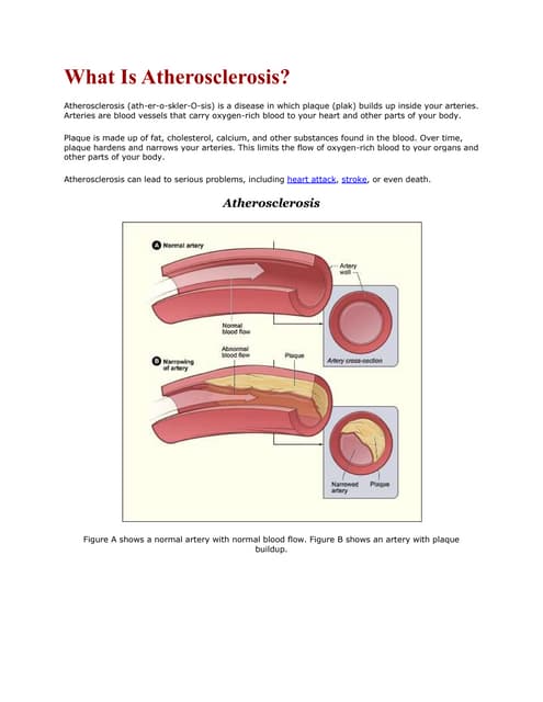 Atherosclerosis-All about Atherosclerosis,intoduction, causes ...