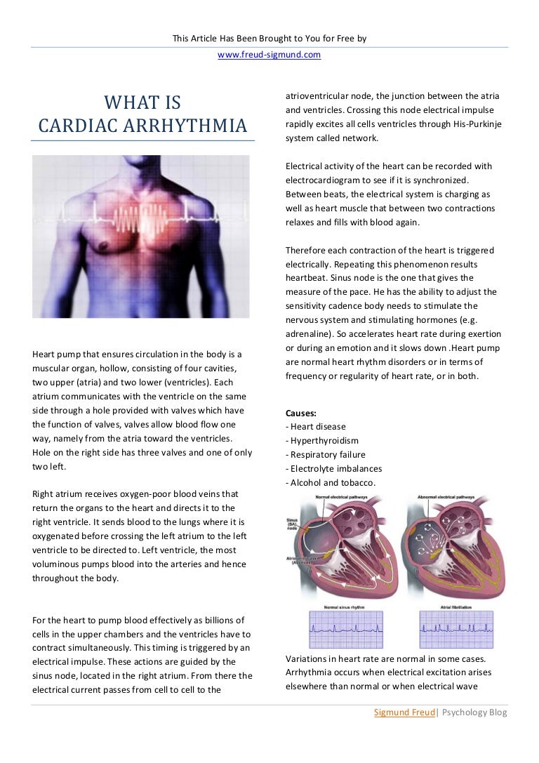 What Is Cardiac Arrhythmia what-is-cardiac-arrhythmia
