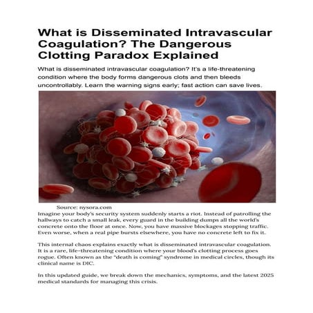 Disseminated intravascular coagulation ppt | PPTX
