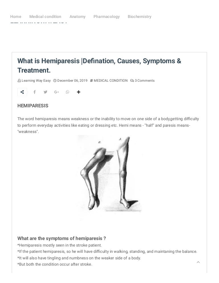 What Is Hemiparesis Defination Causes Symptoms And Treatment