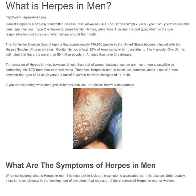 Genital Herpes Men First Signs Follow For Part 3 Where I’ll Discuss