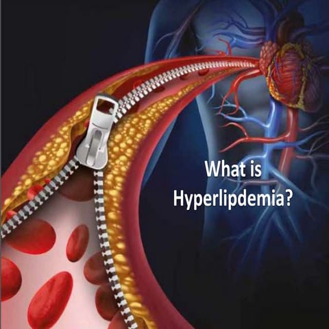What is hyperlipidemia | PPTX