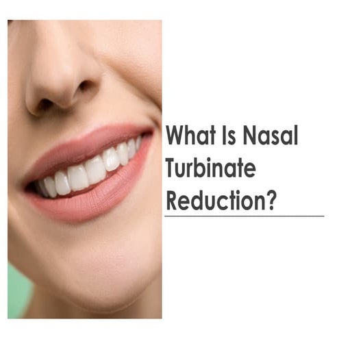 What Is Nasal Turbinate Reduction? | PDF