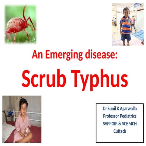 What is new in Scrub typhus in children 2024.pptx