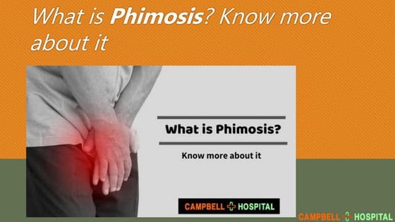 phimosis final.pptx
