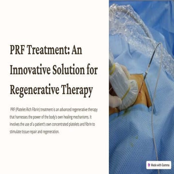 Platelet-rich fibrin (PRF) or leukocyte- and platelet-rich fibrin (L ...
