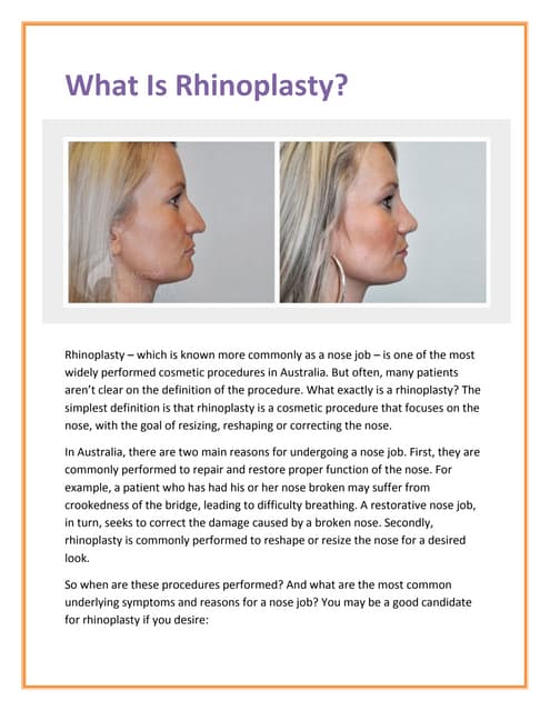 Dean toriumi, m.d. nose shape and rhinoplasty | PDF