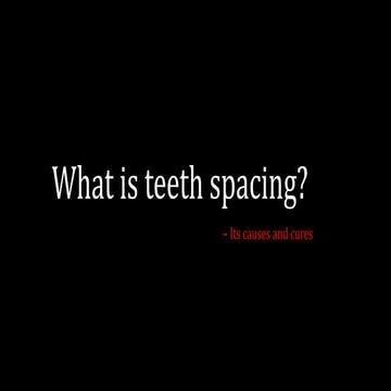 What is teeth spacing? – Its causes and cures | PPTX