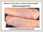 Psoriasis and Miracles with Homoeopathy | PDF