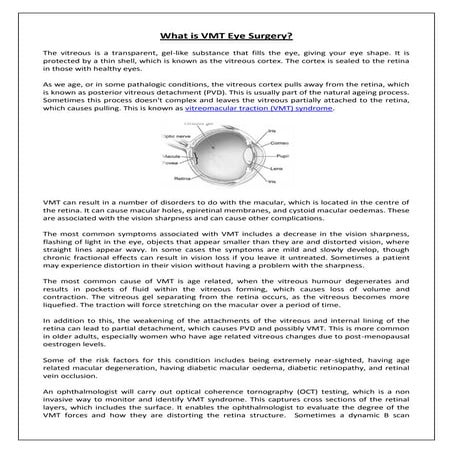 What is VMT Eye Surgery | PDF