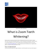 Zoom whitening process - llkabat