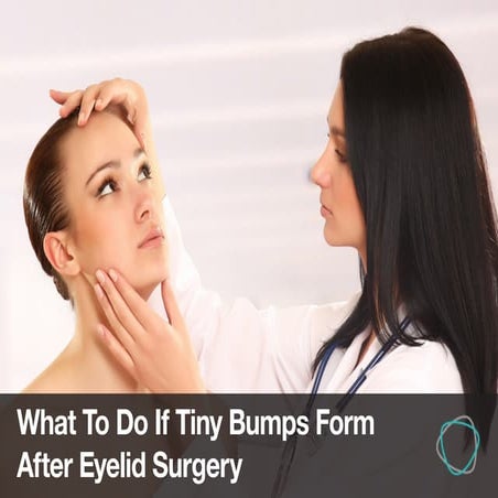 What To Do If Tiny Bumps Form After Eyelid Surgery | PDF