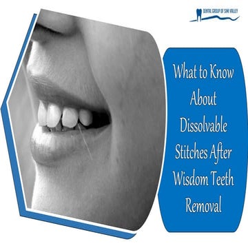 What to Know About Dissolvable Stitches After Wisdom Teeth Removal | PPTX