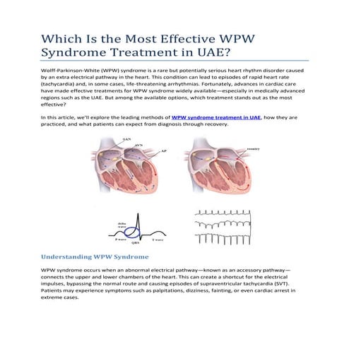 Which Is the Most Effective WPW Syndrome Treatment in UAE.pdf