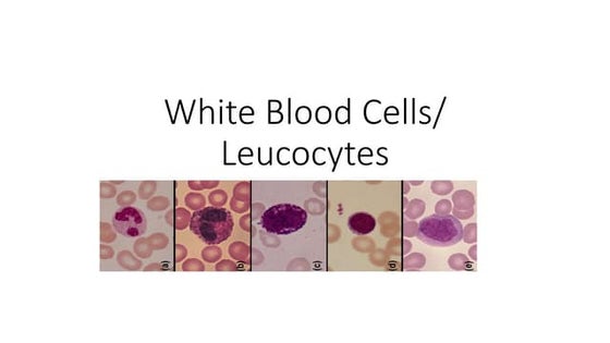 Leukocytosis | PPT