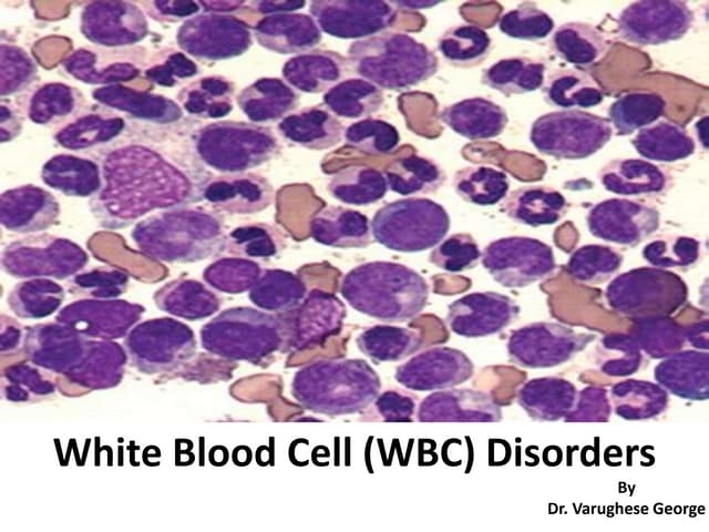 Wbc & platelets anomalies | PPTX