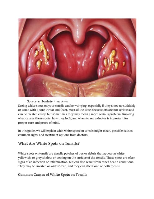 NAD Medical Abbreviation: Understanding Its Meaning and Significance in ...