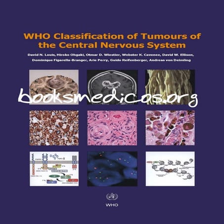 RECENT WHO 2021 CLASSIFICATION OF CNS TUMOURS | PDF