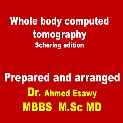 Whole body computed tomography urinary bladder | PPTX