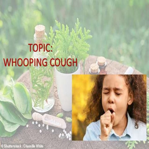 Whooping cough | PDF