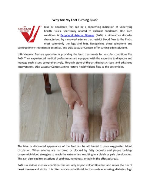 Vascular Specialist in Perth- A-vascular | PPT