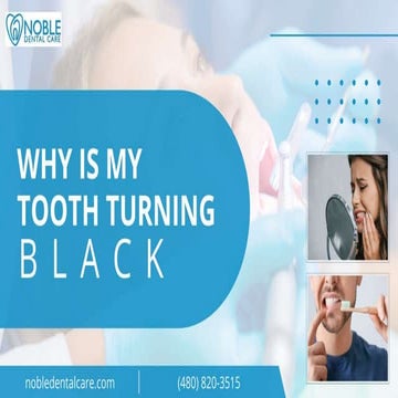 Why is My Tooth Turning Black.pptx